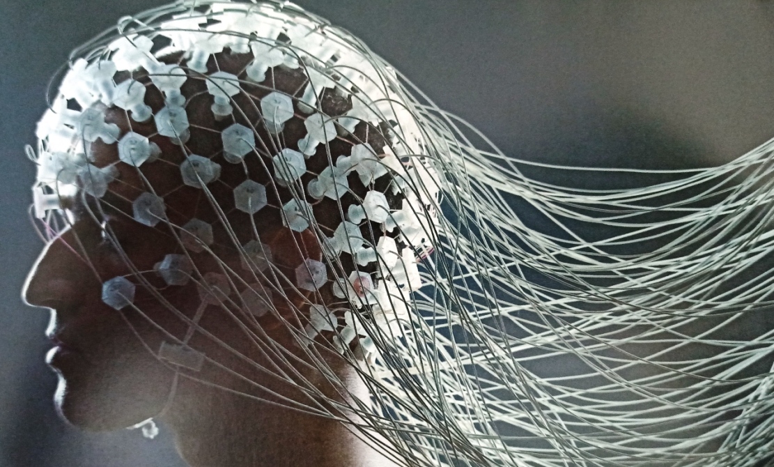 The Electroencephalogram – 1924